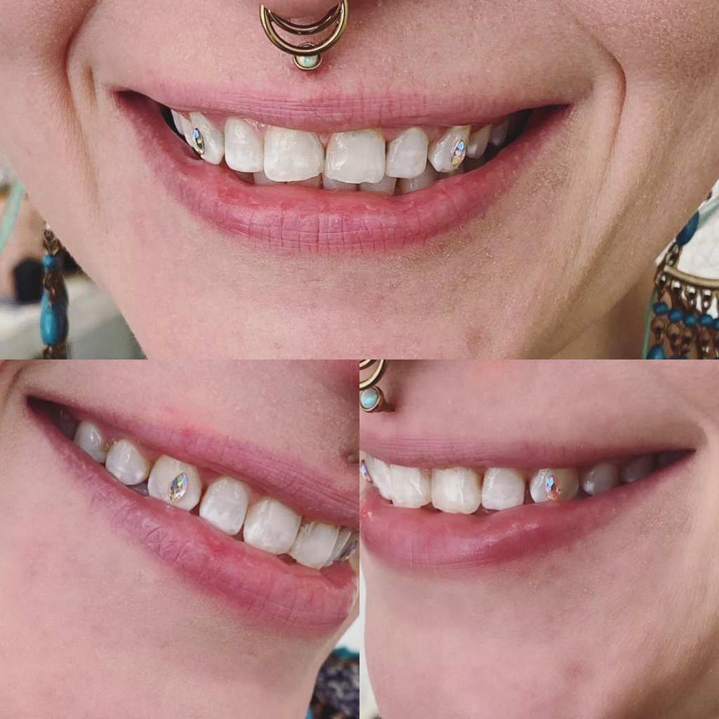 Tooth Gems – Kiwi Louise Piercing